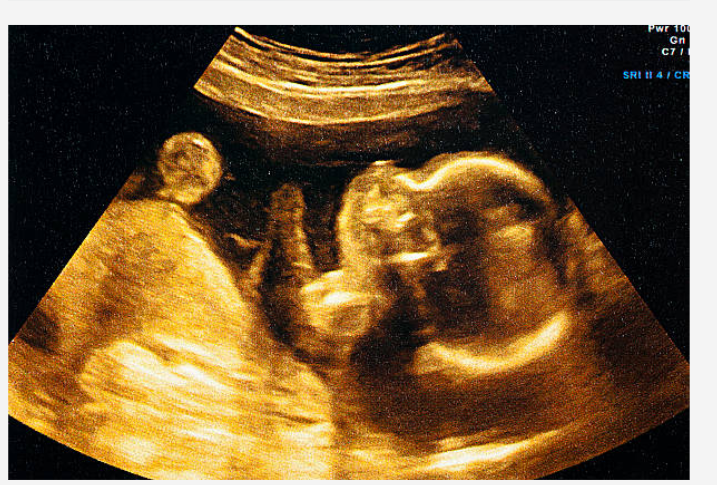 HOTNESS OF THE WOMB: CAUSES AND ITS REMEDIES - Women Times